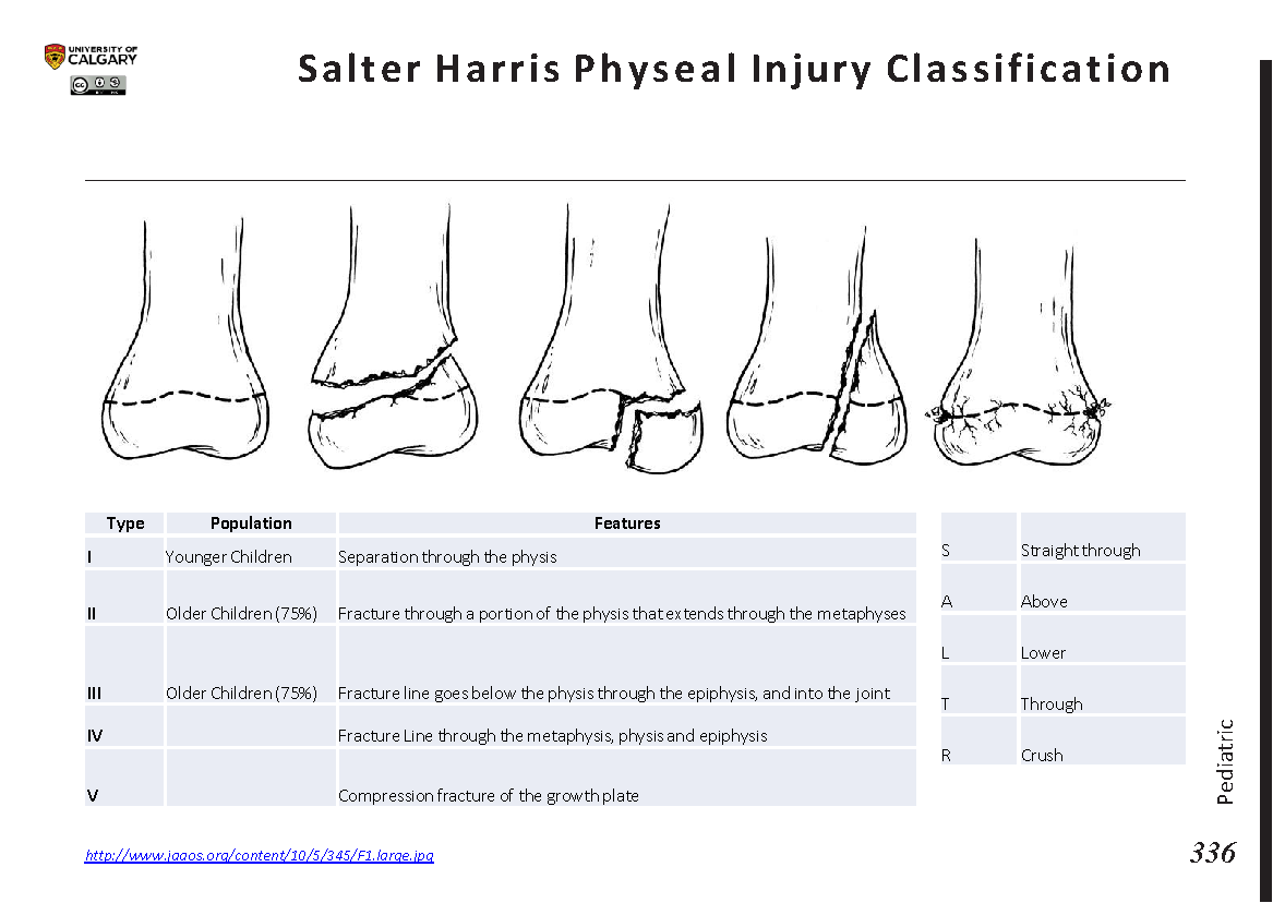 SALTER HARRIS PHYSEAL INJURY CLASSIFICATION SYSTEM - Blackbook : Blackbook